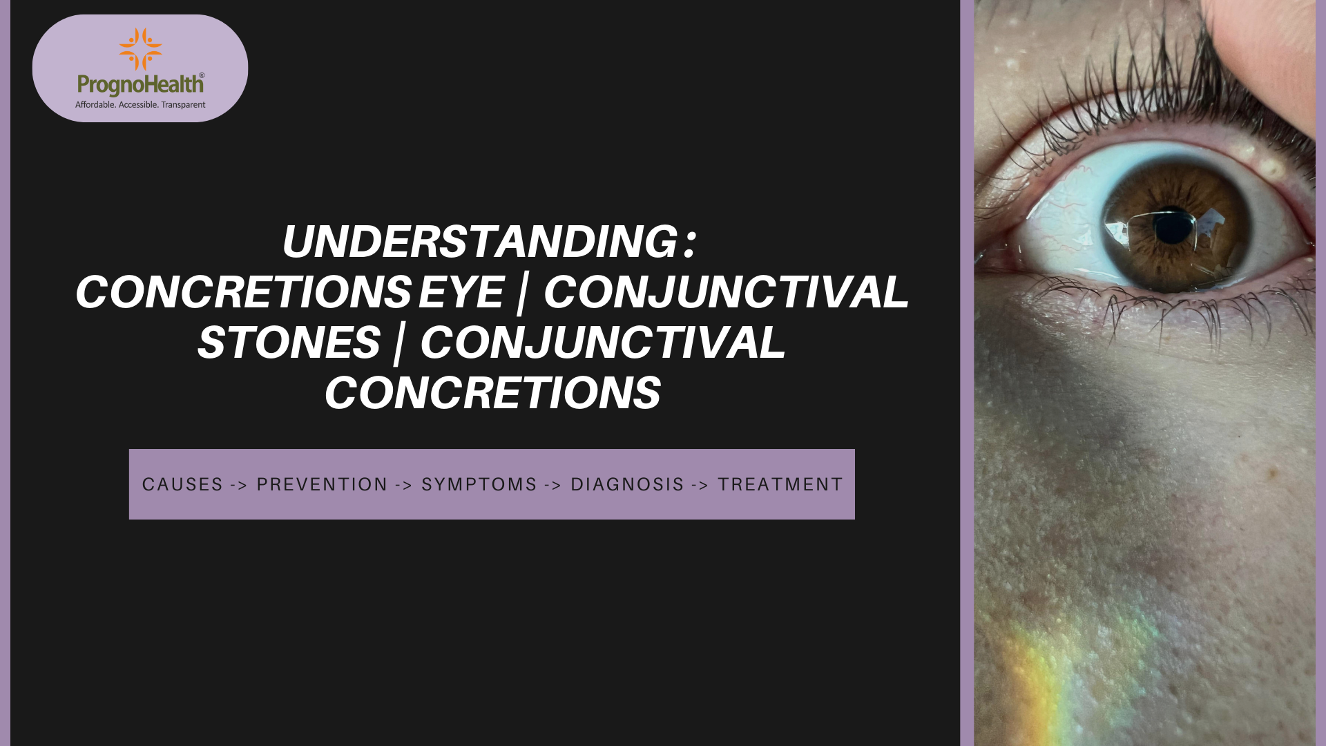 Conjunctival concretions - Healthcare Marketplace