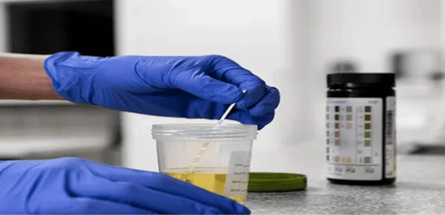Bile Salts and Bile Pigments (BSBP) Test - Healthcare Marketplace